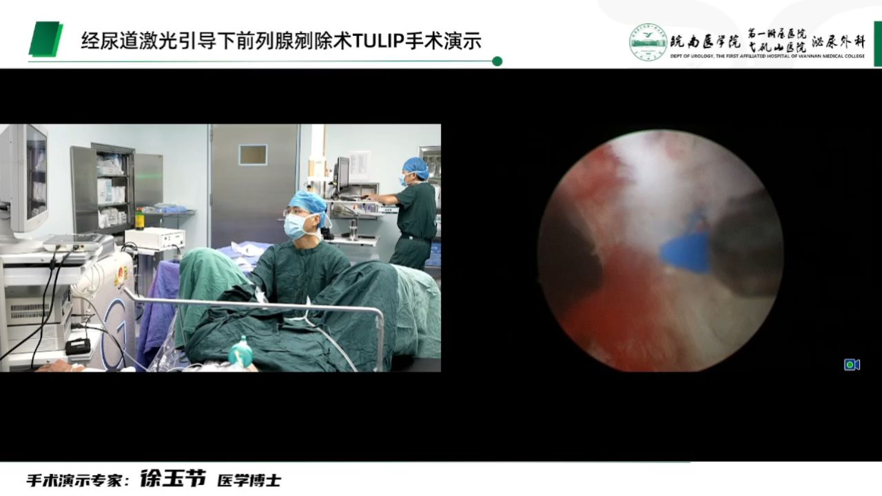 经尿道激光引导下前列腺剜除术TULIP手术演示_高清1080P在线观看平台_腾讯视频